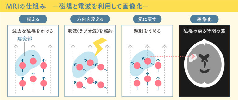 [Vol.18]MRIってどんな検査？ ｜ なるほど！MRIの仕組み - 医療法人 横浜平成会 平成横浜病院