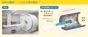 [Vol.18]MRIってどんな検査？ ｜ なるほど！MRIの仕組み - 医療法人 横浜平成会 平成横浜病院